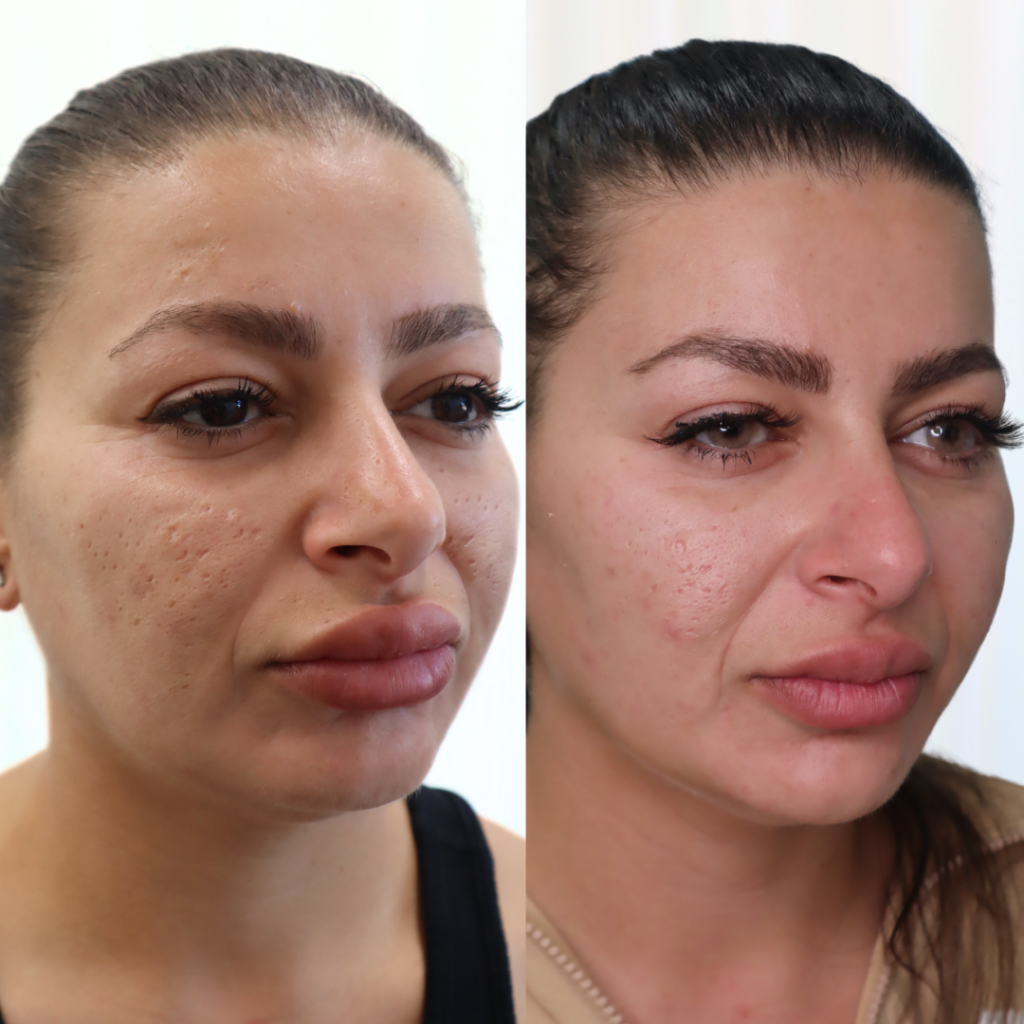 Treatments - Injxu Cosmetics | Aesthetics Clinic in Sydney